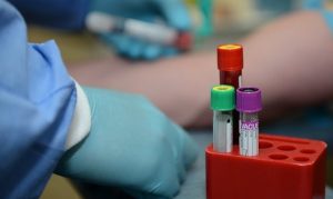 Army Medical Laboratory Specialist (MOS 68K): 2022 Career Details